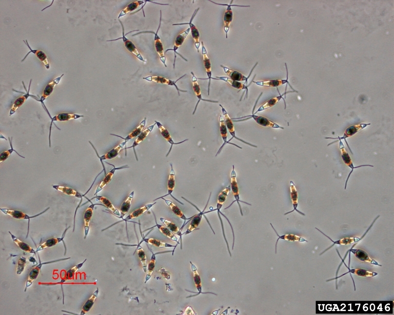 Pestalotiopsis leaf spot (Genus Pestalotiopsis R. L. Steyaert)