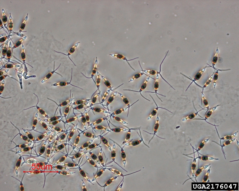 Pestalotiopsis leaf spot (Genus Pestalotiopsis R. L. Steyaert)