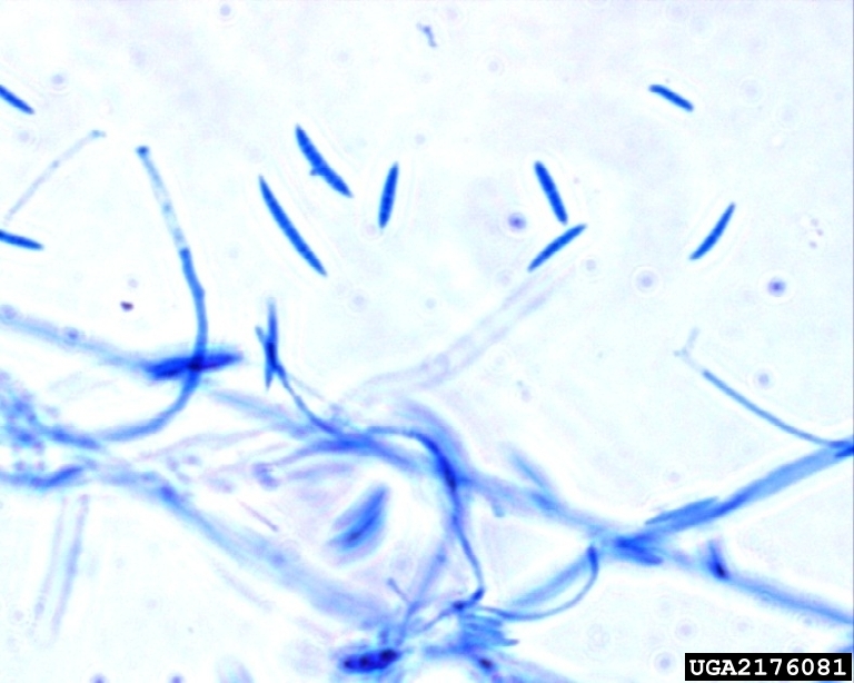 Fusarium wilts, blights, rots and damping-off (Genus Fusarium Link)
