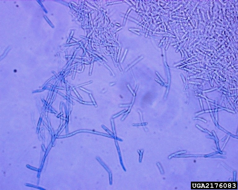 Arthrographis fungi (Genus Arthrographis G. Cochet ex Sigler & J.W ...