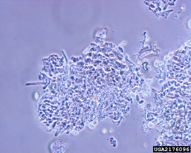 powdery mildew (Podosphaera pannosa (Wallr.) de Bary)