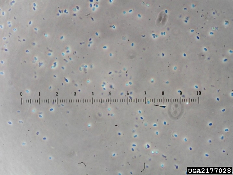 Phoma blights (Genus Phoma Sacc.)