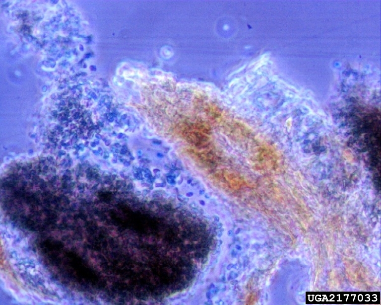 Phoma blights (Genus Phoma Sacc.)