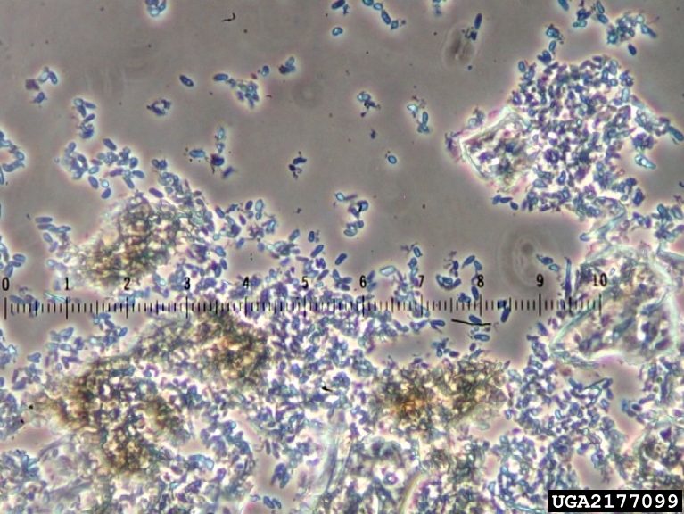 Phoma blights (Genus Phoma Sacc.)