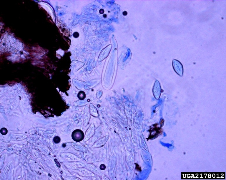 Botryosphaeria rots and cankers (Genus Botryosphaeria Ces. & De Not.)