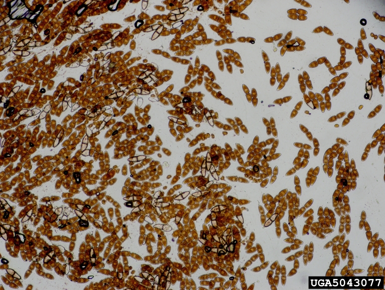 cedar-apple rust (Gymnosporangium juniperi-virginianae Schwein.)