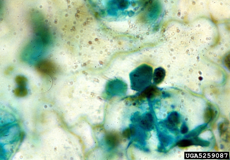 tobacco mosaic virus (TMV) (Tobamovirus Tobacco mosaic virus)