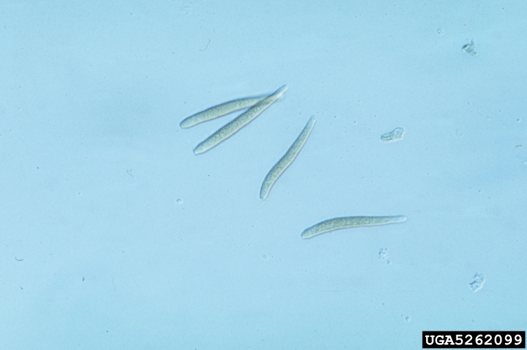 leaf spot (Passalora sequoiae (Ellis & Everh.) Y.L. Guo & W.H. Hsieh)