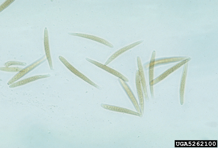 leaf spot (Passalora sequoiae (Ellis & Everh.) Y.L. Guo & W.H. Hsieh)