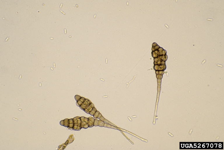 Alternaria blight (Alternaria panax Whetzel)
