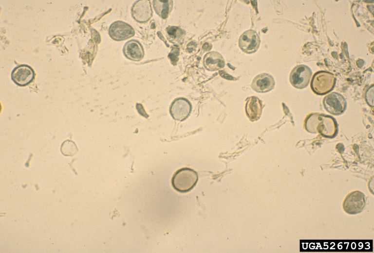 guava rust (Puccinia psidii)