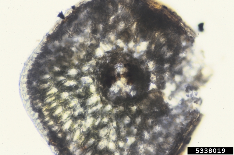 Rhizosphaera needle cast (Rhizosphaera kalkhoffii)