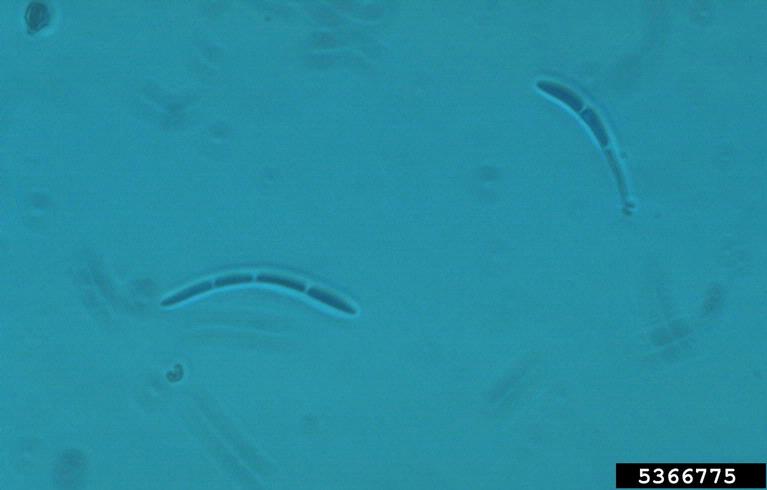 Mycosphaerella fungi (Genus Mycosphaerella Johanson)