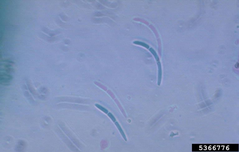 Mycosphaerella fungi (Genus Mycosphaerella)