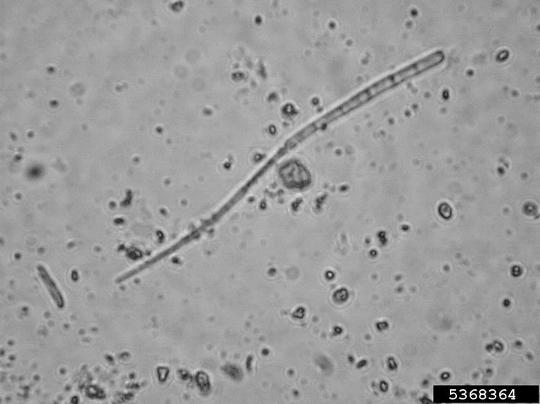 Cercospora fungi (Genus Cercospora Fresen.)