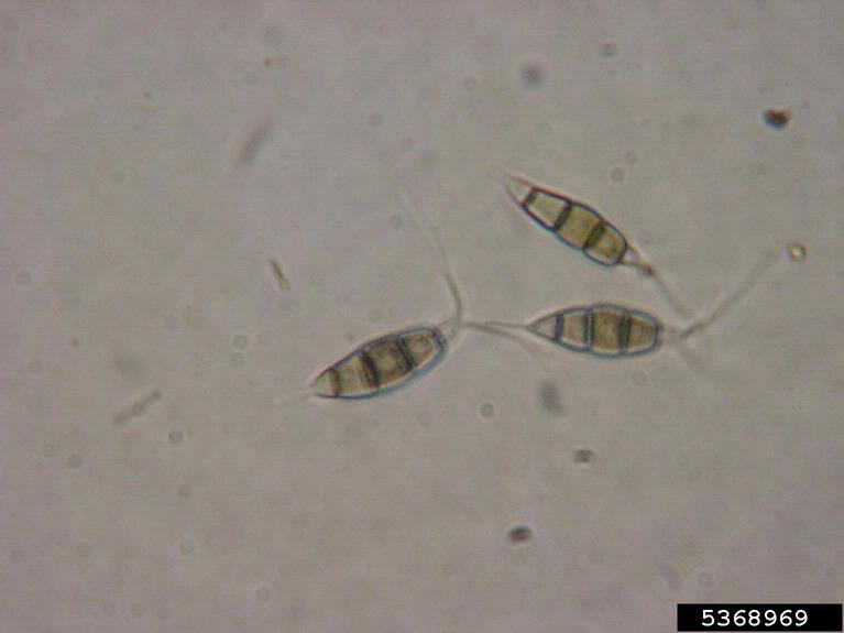 Pestalotiopsis leaf spot (Genus Pestalotiopsis R. L. Steyaert)