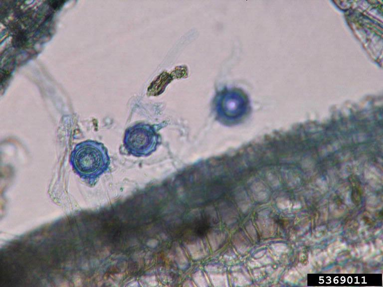 Pythium diseases (Genus Pythium Pringsh.)