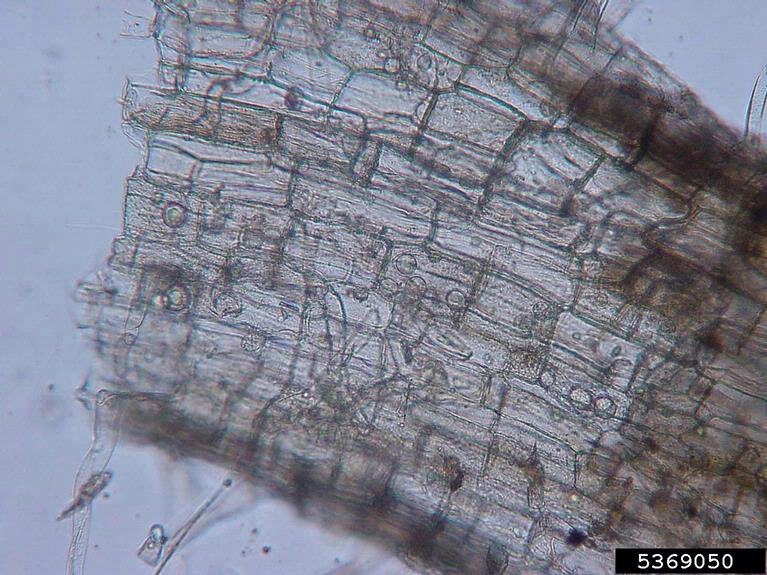 Pythium diseases (Genus Pythium Pringsh.)