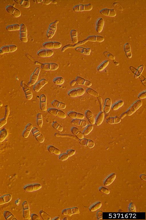 Gibberella fungus (Gibberella tricincta El-Gholl, McRitchie, Schoult ...