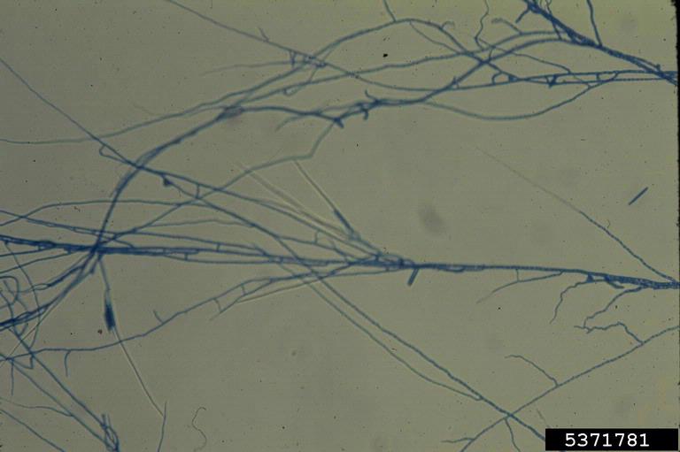 Cylindrocladium fungus (Cylindrocladium avesticulatum D.L. Gill ...