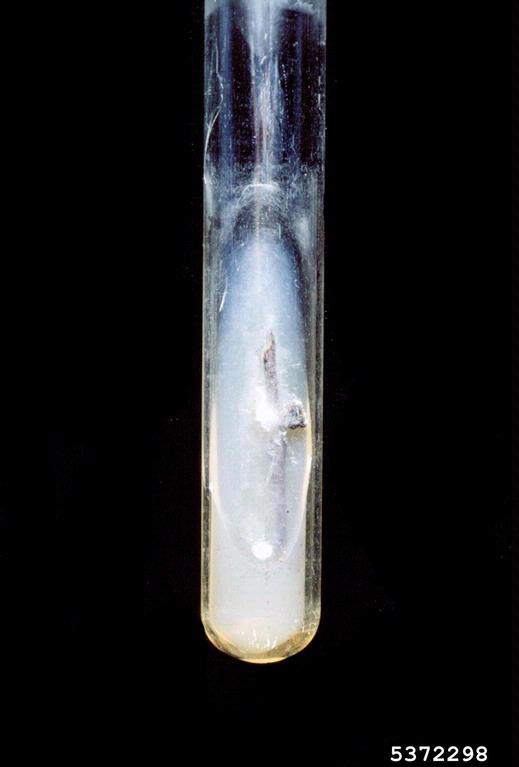 Cylindrocladium fungus (Cylindrocladium clavatum Hodges & L.C. May)