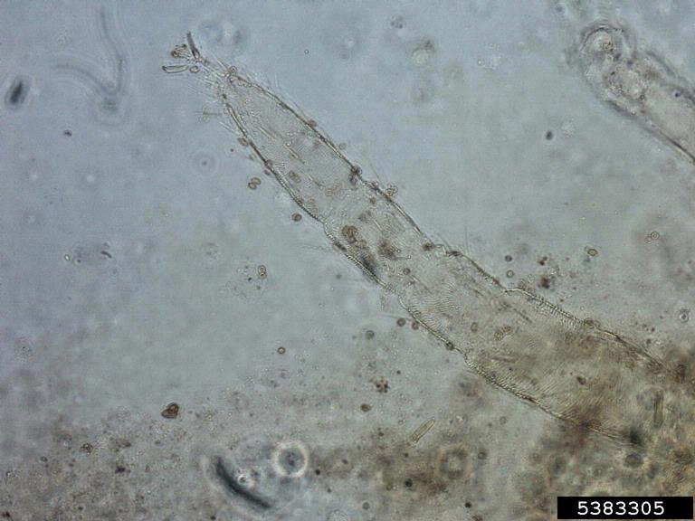 Bdellid mite (Family Bdellidae)