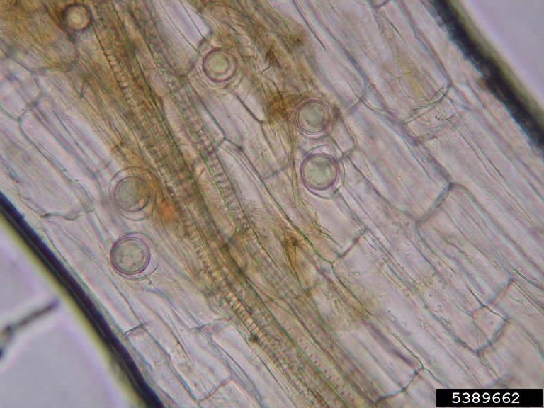 Pythium diseases (Genus Pythium Pringsh.)