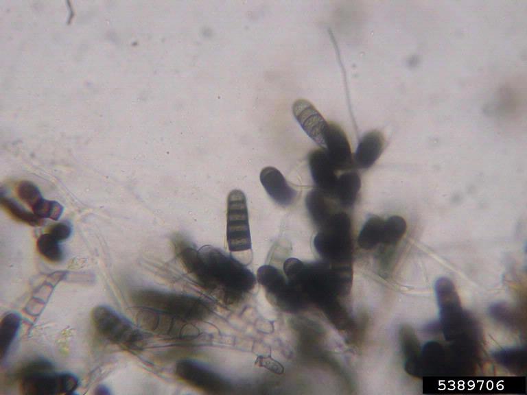 black root rot (Thielaviopsis basicola)