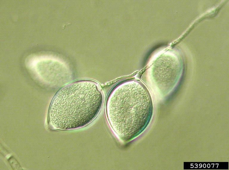 Phytophthora Infestans Microscope