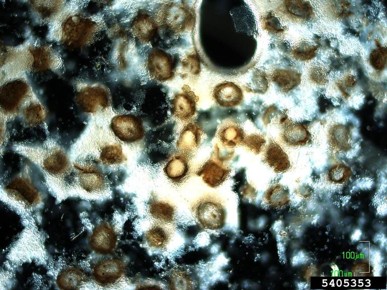 Rhizosphaera needle cast (Rhizosphaera kalkhoffii Bubak)