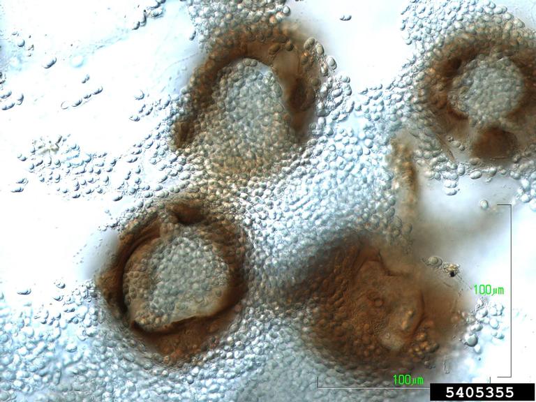 Rhizosphaera needle cast (Rhizosphaera kalkhoffii)