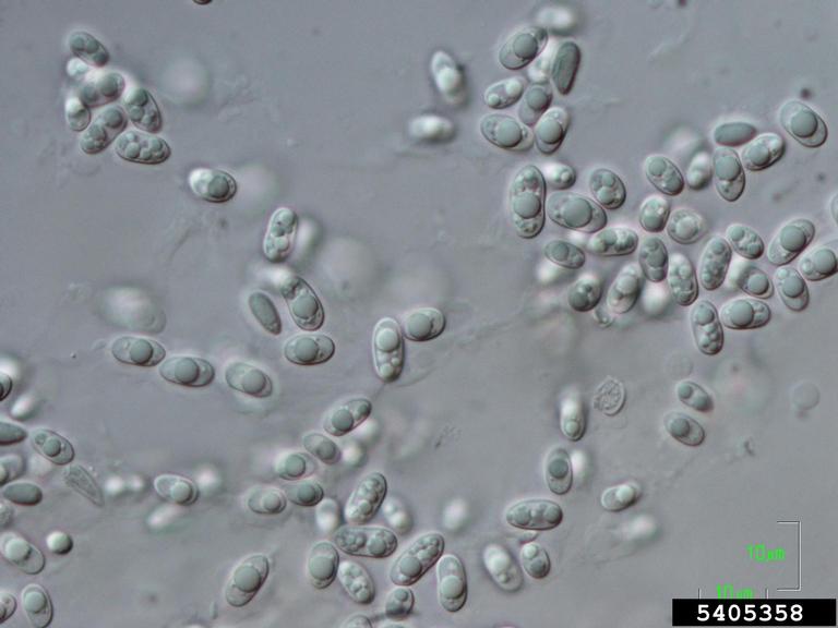 Rhizosphaera needle cast (Rhizosphaera kalkhoffii Bubak)