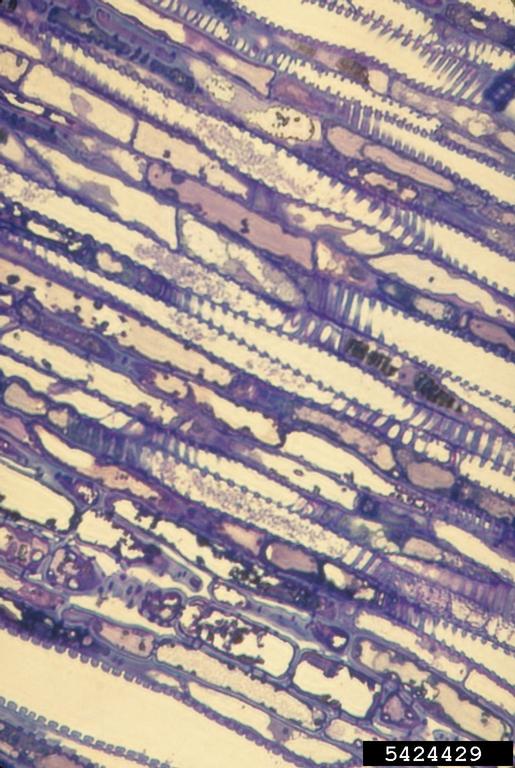 bacterial leaf scorch (Xylella fastidiosa)