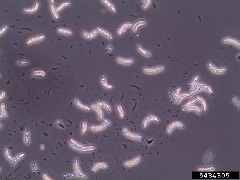 walnut anthracnose (Gnomonia leptostyla)