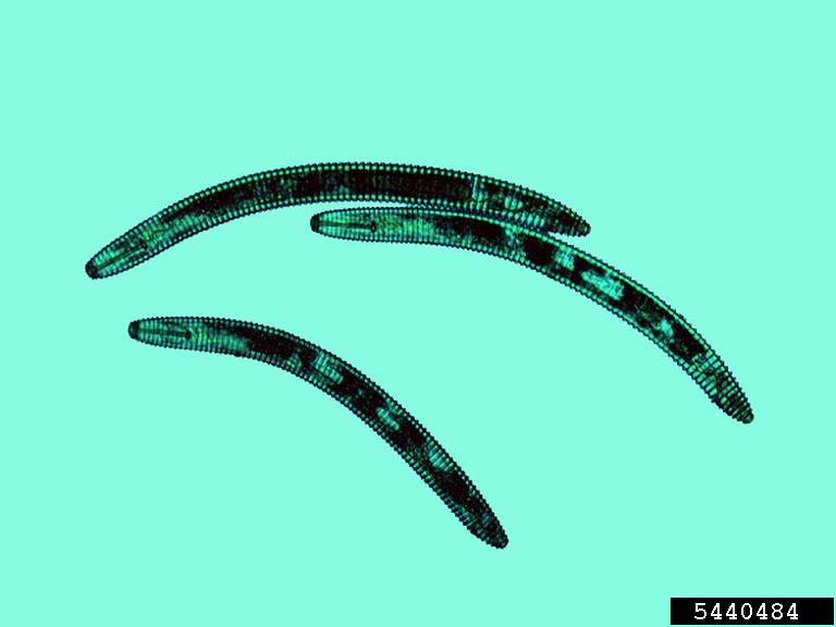 ring nematodes (Genus Criconemella)