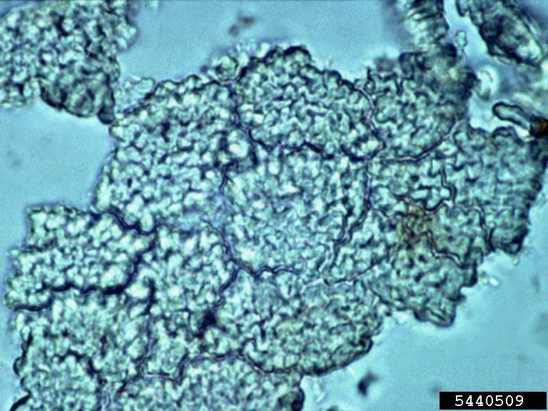 cyst nematodes (Genus Heterodera Schmidt, 1871)