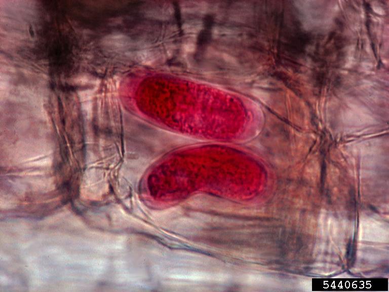 lesion nematode (Genus Pratylenchus)