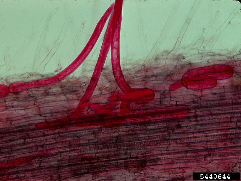 lesion nematode (Genus Pratylenchus)