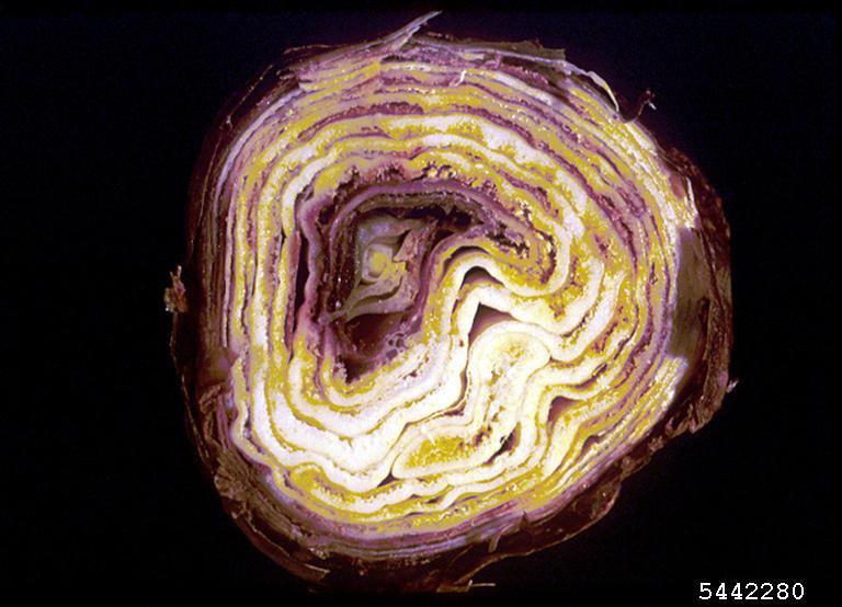alfalfa stem nematode (Ditylenchus dipsaci)