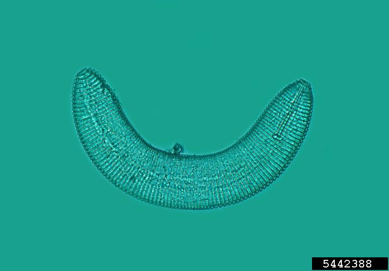 ring nematode (Genus Mesocriconema)