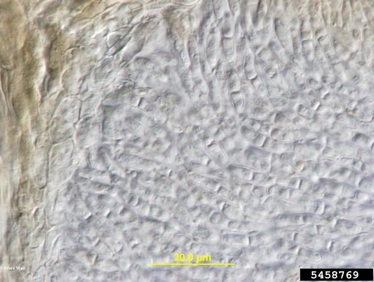 Phoma blight (Phoma clematidina)