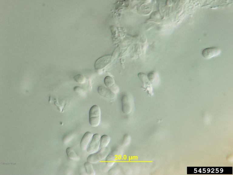 Ascochyta fungi (Genus Ascochyta Lib.)