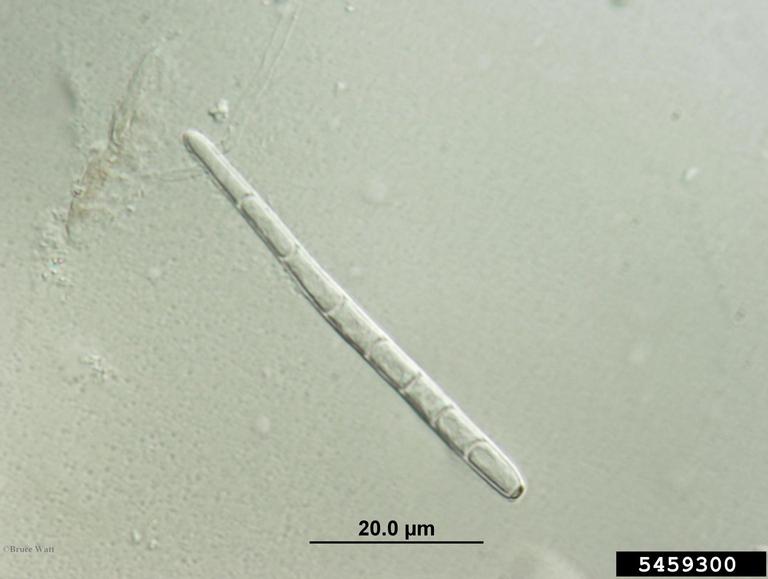 Cercospora fungi (Genus Cercospora Fresen.)