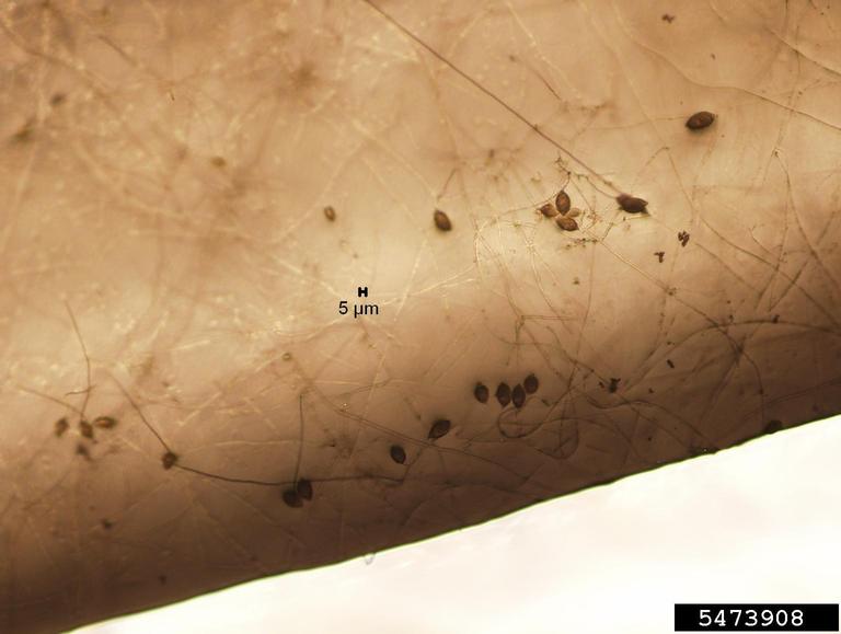 Phytophthora blight (Phytophthora capsici)