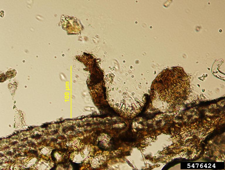 Rhizosphaera needle cast (Rhizosphaera pini)