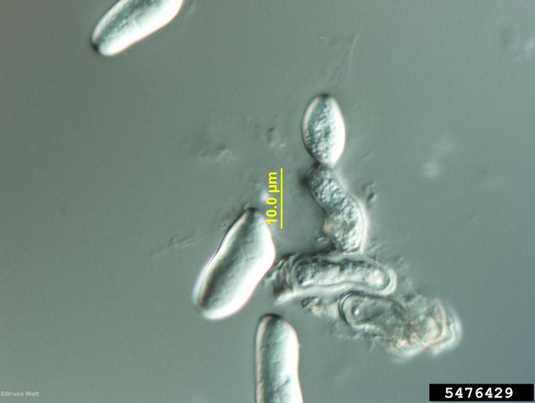 Rhizosphaera needle cast (Rhizosphaera pini)