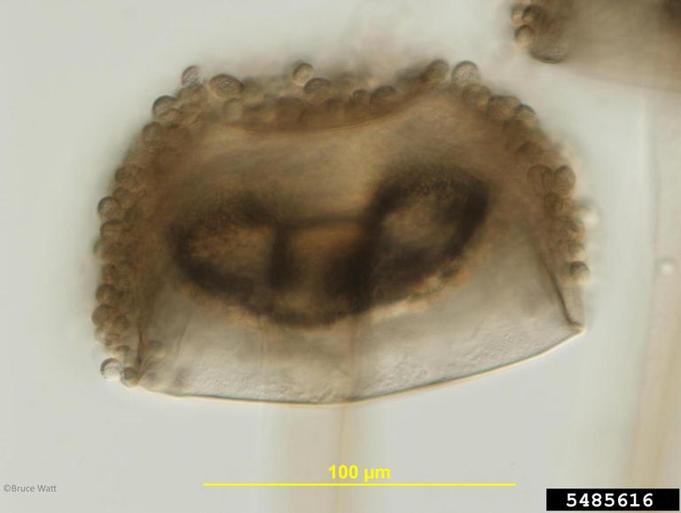 bread mold (Rhizopus stolonifer)