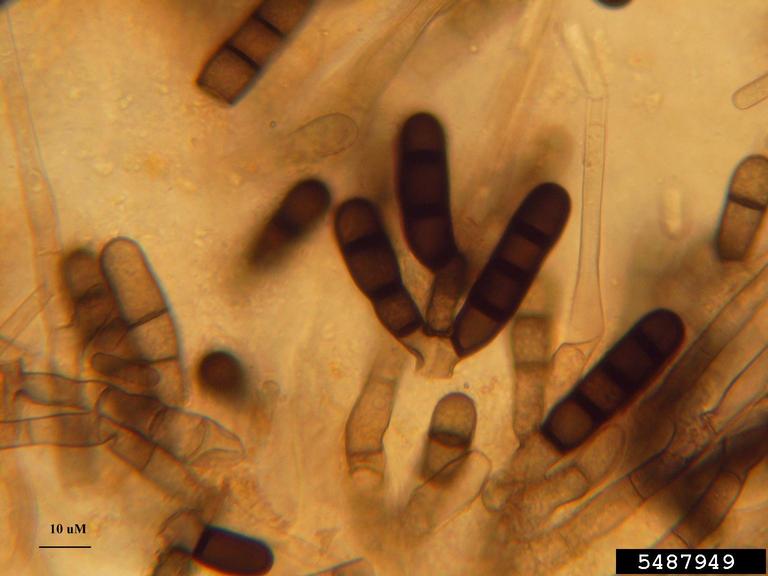 Thielaviopsis basicola (Berk. & Broome) Ferraris (Synonym for ...