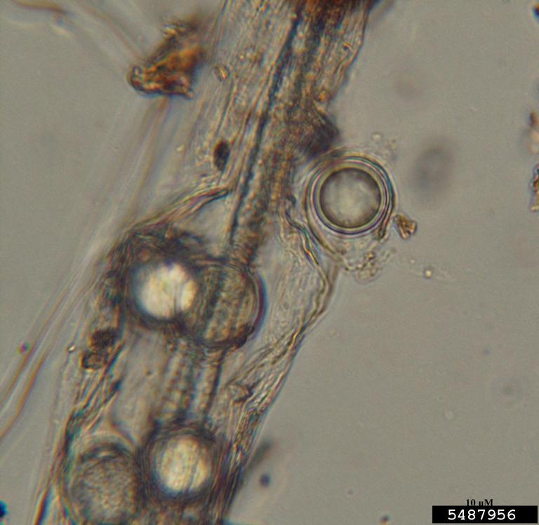 Pythium diseases (Genus Pythium Pringsh.)