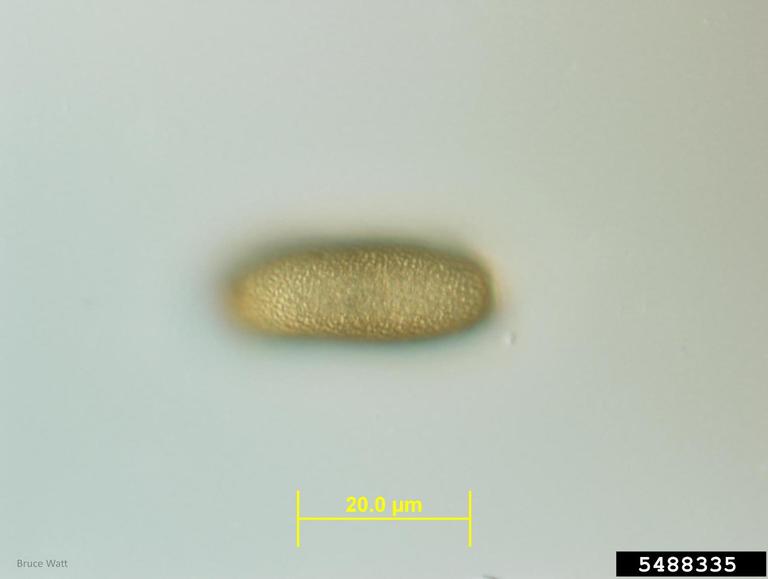 Diplodia blight (Sphaeropsis sapinea ) on mugo pine (Pinus mugo ) - 5488335